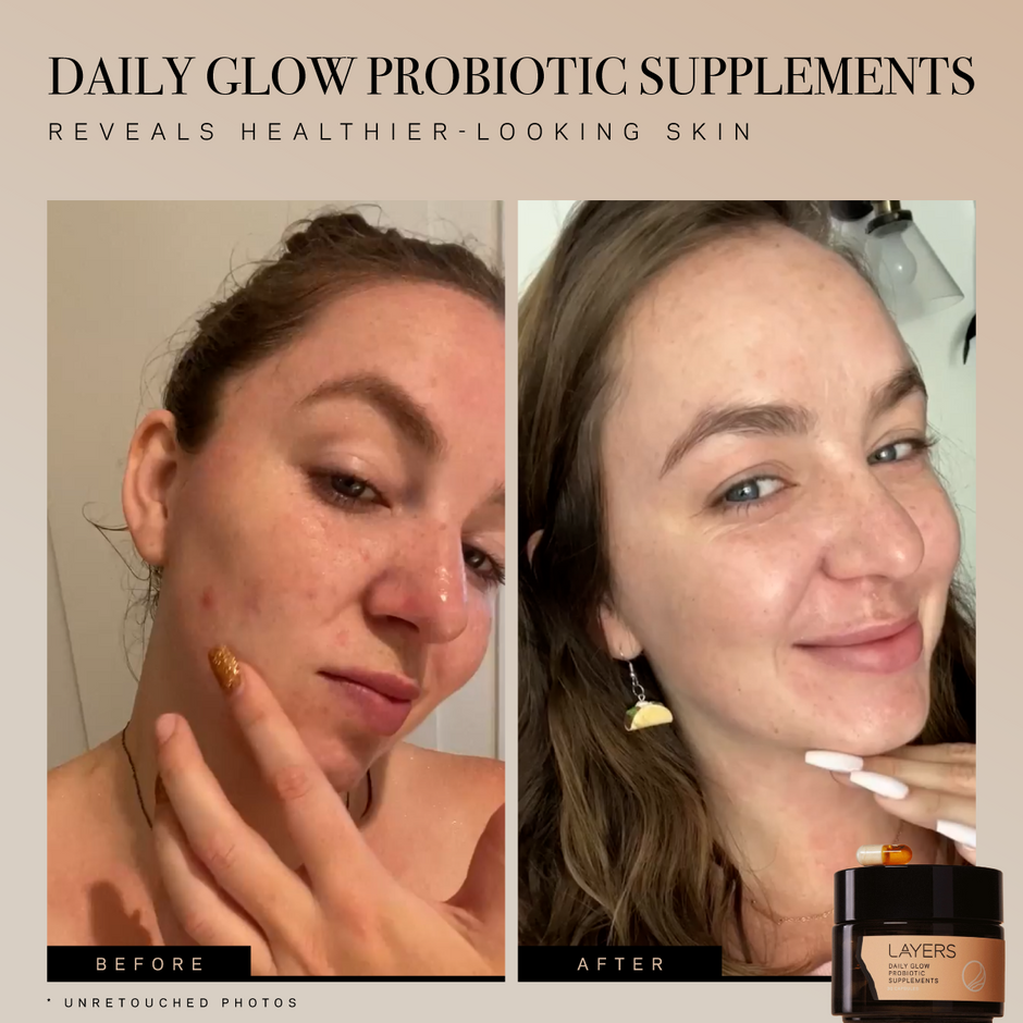 Layers Probiotic Skincare | Best Skin Care Supplements | USA