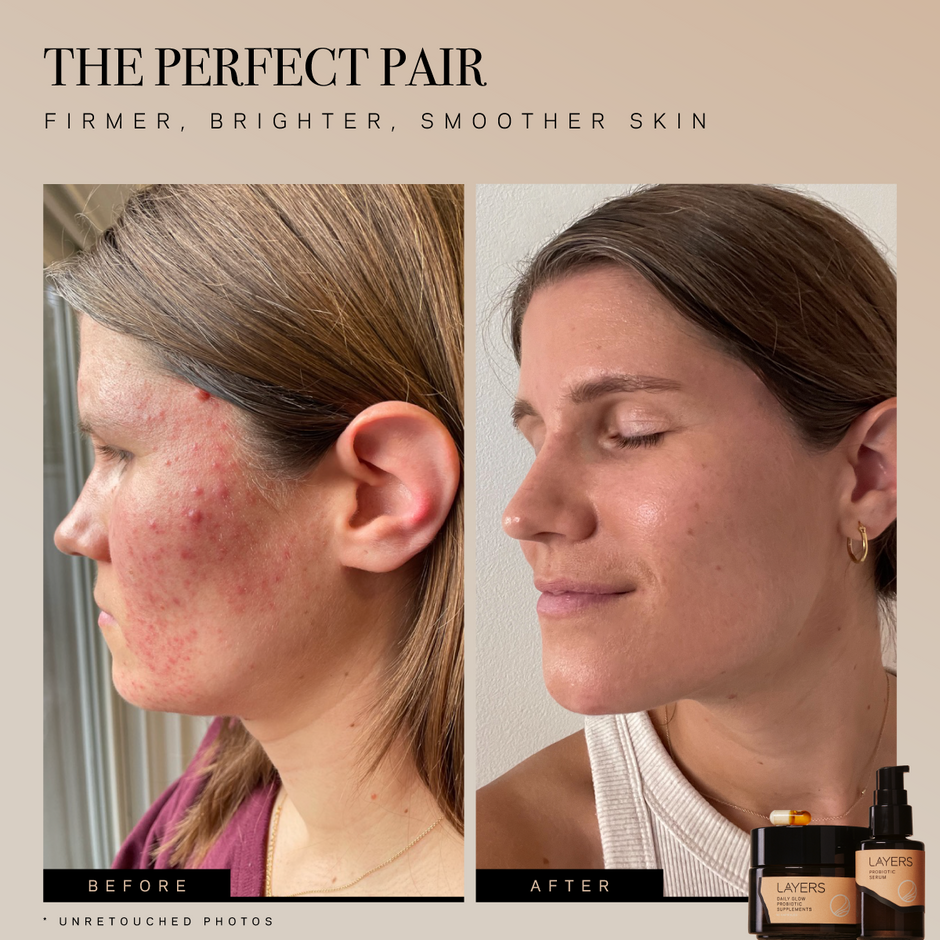 Layers Probiotic Skincare | Best Skin Care Supplements | USA